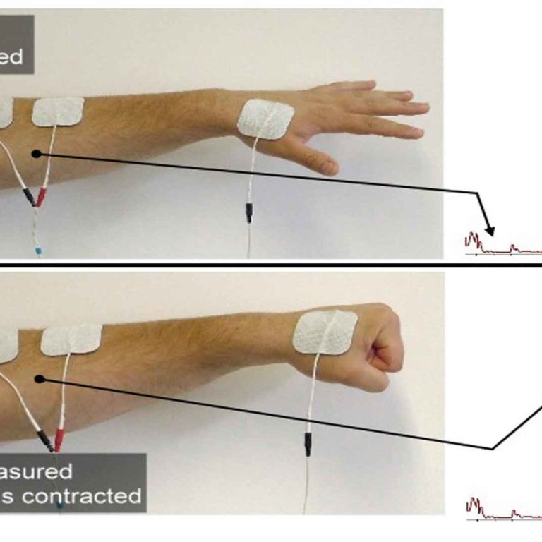 Biofeedback & Neurofeedback Therapy | Control you performance & health