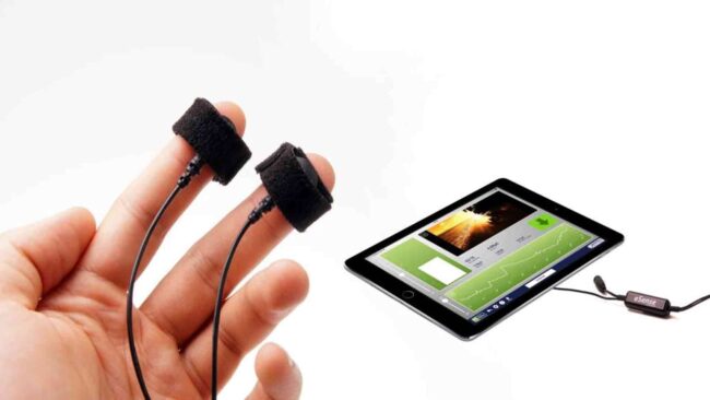 Electrodermal skin activity biofeedback to manage stress