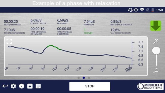 Galvanic skin response biofeedback to manage stress