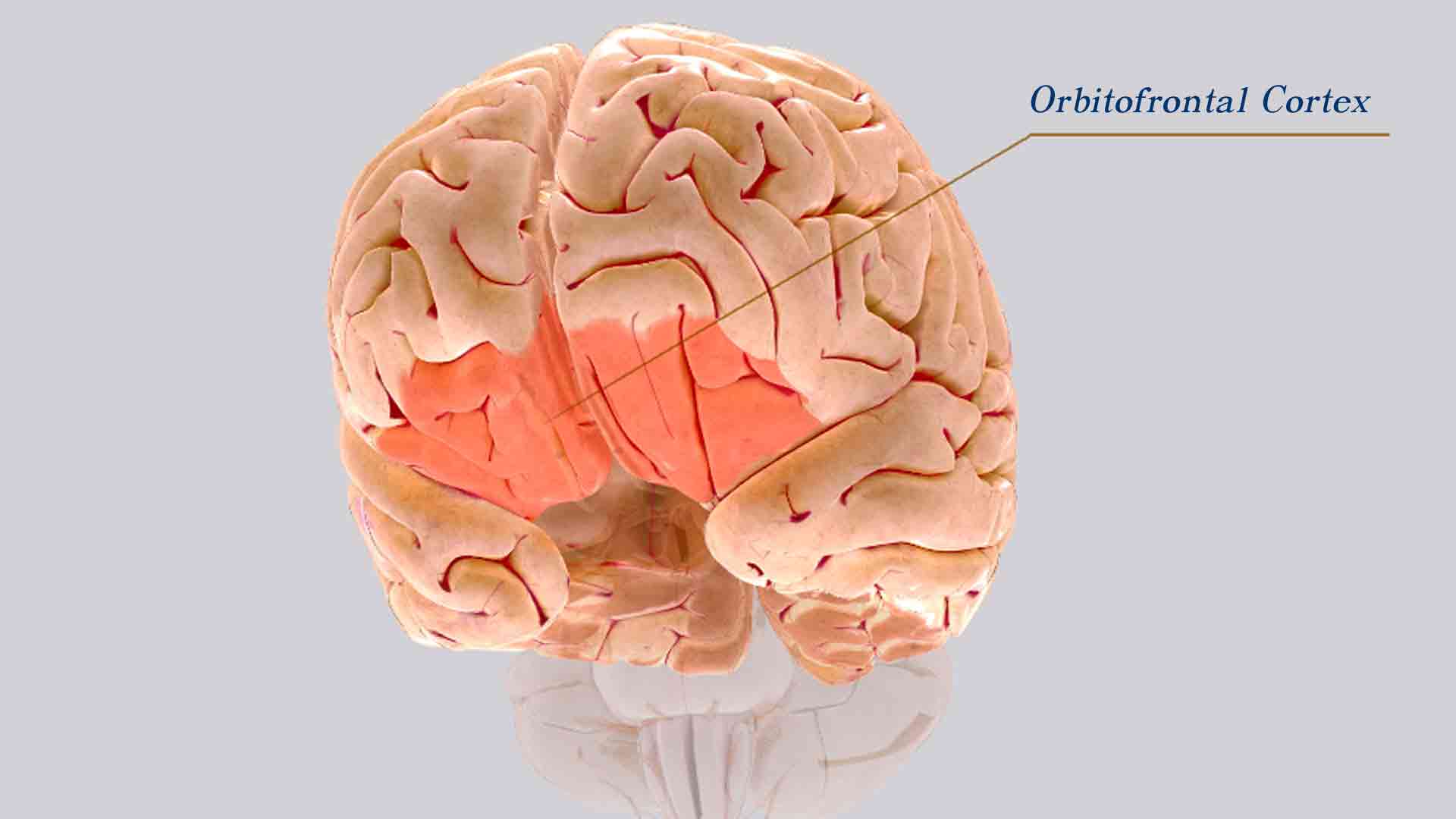 Neurofeedback management of the Anxiety Disorders