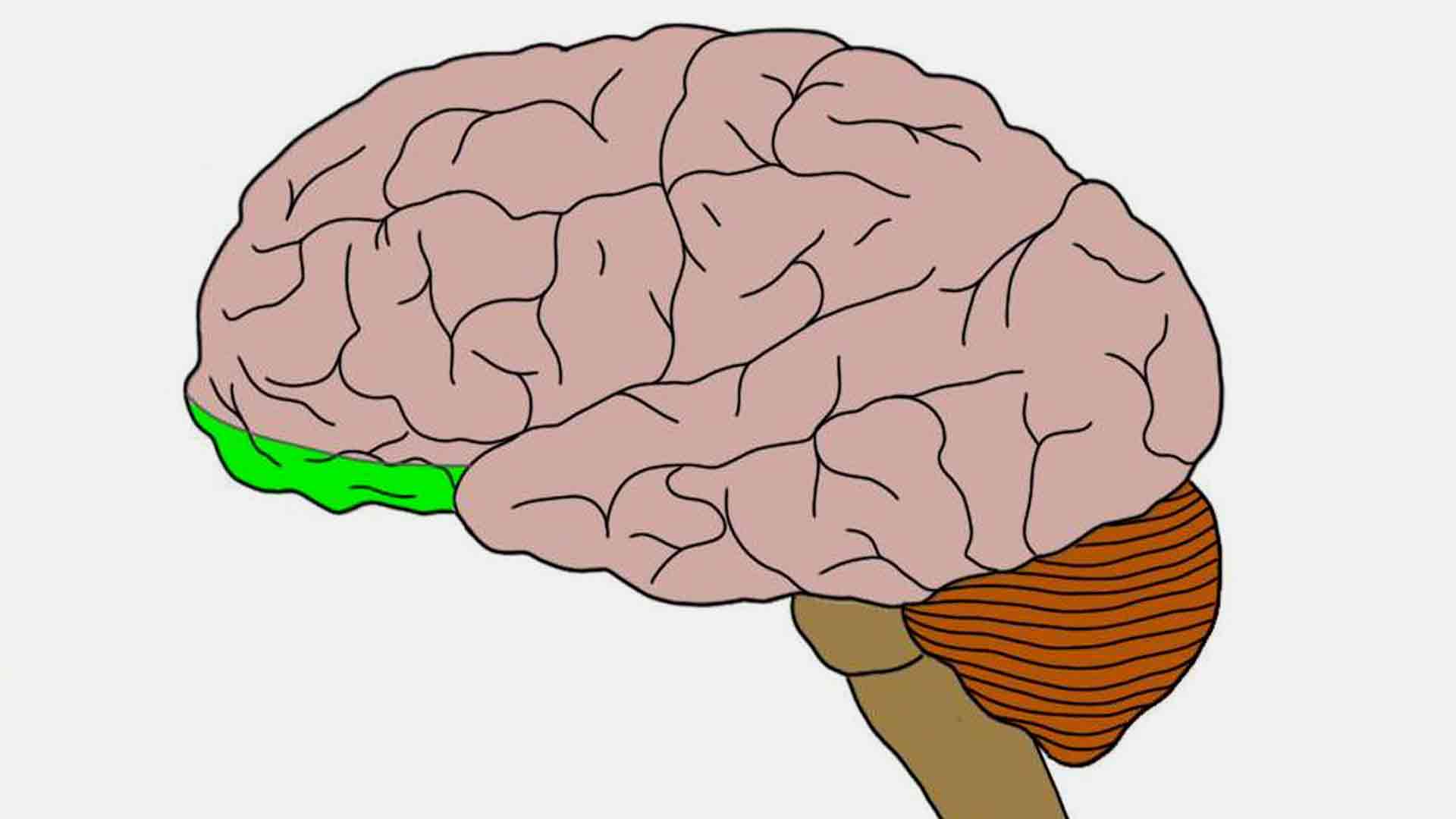 Neurofeedback management of the Anxiety Disorders