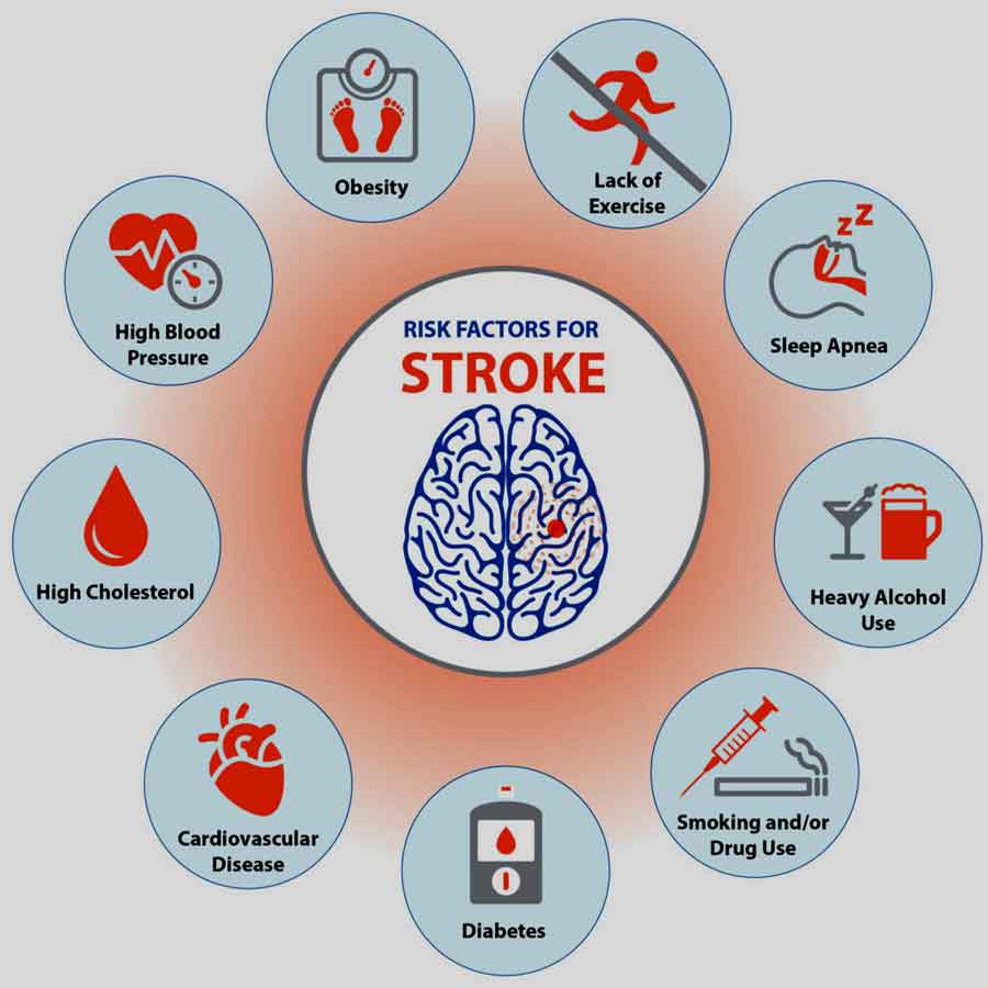 Mini Stroke Recovery And Prophylaxis With Biofeedback