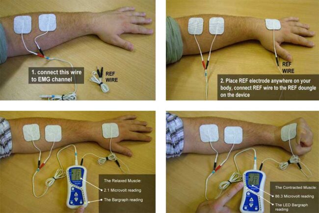 NeuroTrac Simplex EMG Biofeedback Equipment for Muscle Health